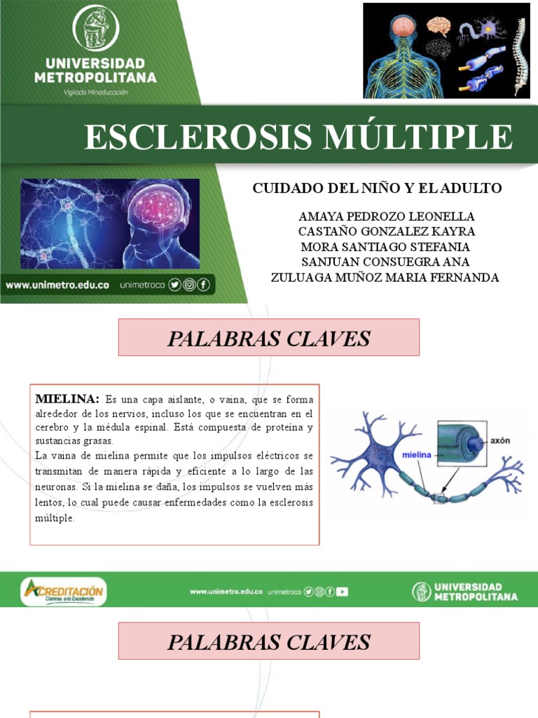 Esclerosis Multiple | PDF | Esclerosis múltiple | Mielina