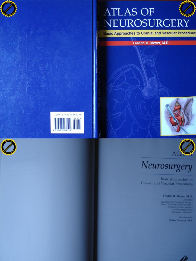 Atlas of Neurosurgery | PDF