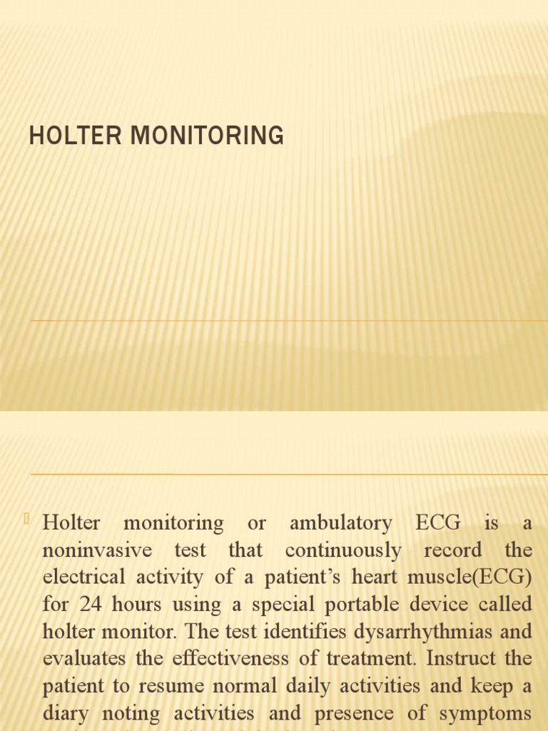 Holter Monitoring | PDF