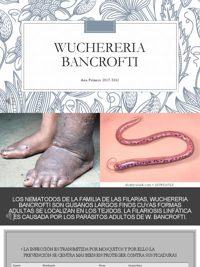 Filariasis Linfática por Wuchereria bancrofti | PDF | Inmunología ...