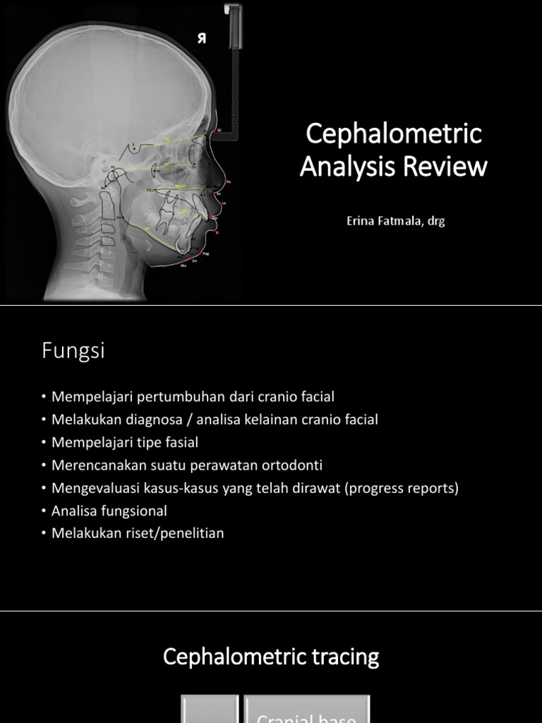 Cephalometric Analysis Review - Erina, DRG | PDF