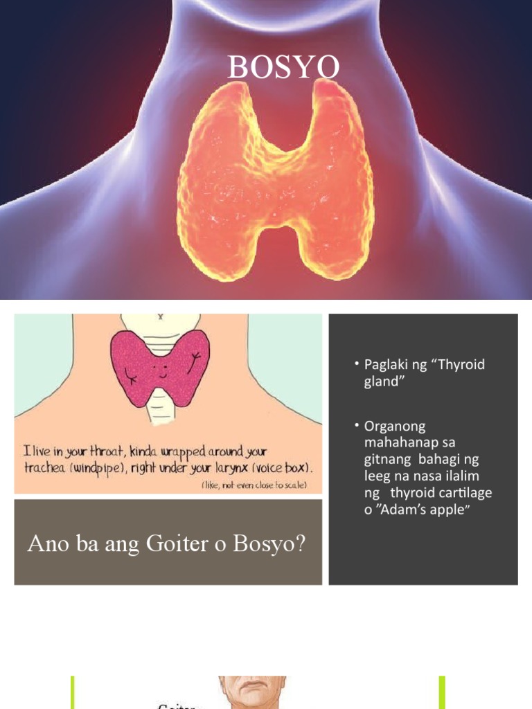 GOITER | PDF