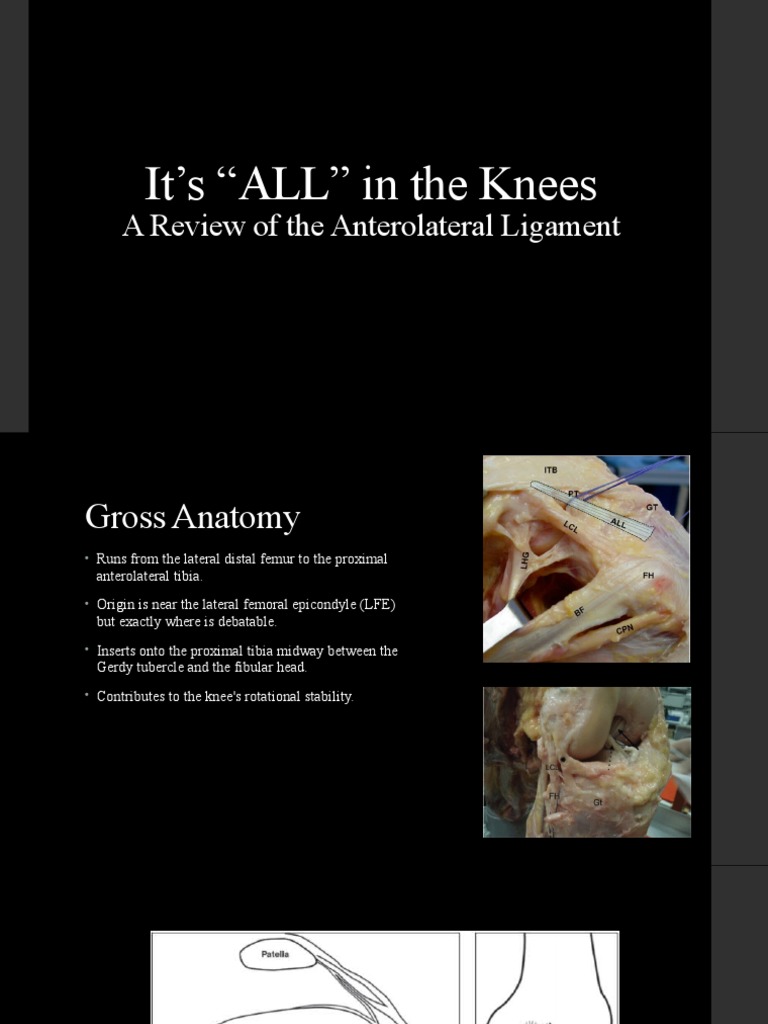 It's "ALL" in The Knees: A Review of The Anterolateral Ligament | PDF ...