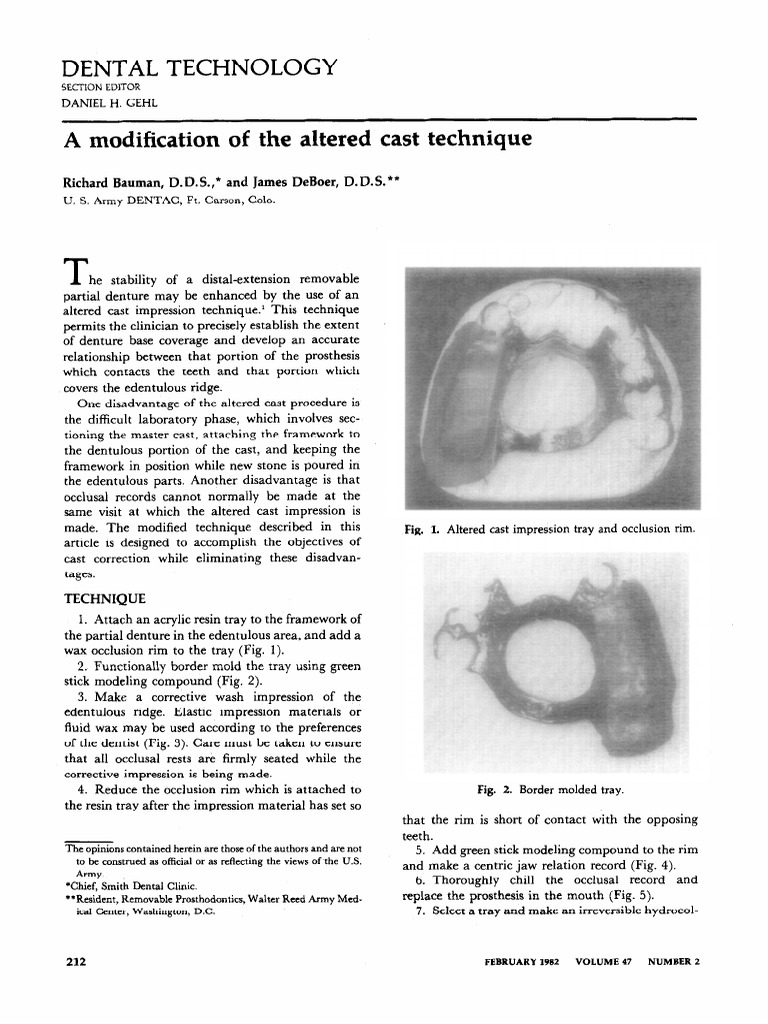 A Modification of The Altered Cast Technique PDF | PDF | Dentures ...