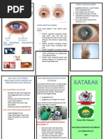 Leaflet Katarak PDF | PDF