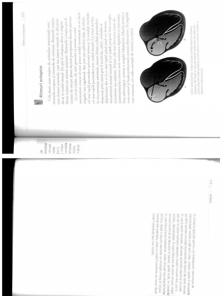 EKG Tot Ce Trebuie Sa Stii | PDF