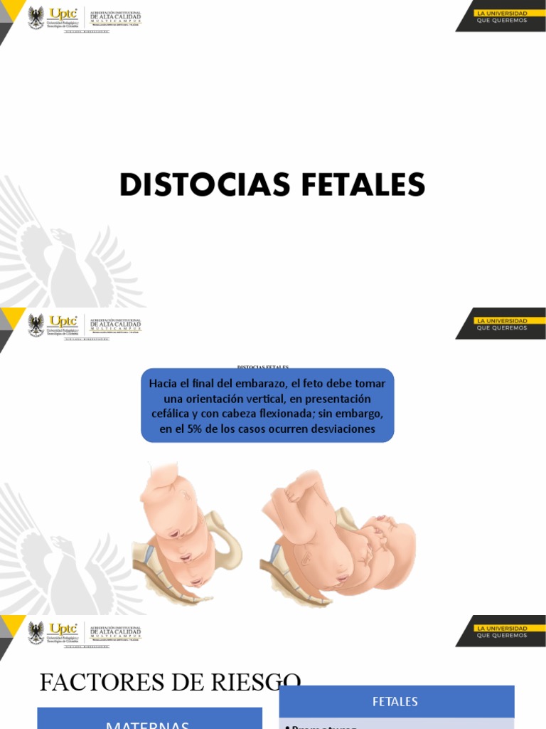 Distocias Fetales Parte 1 | PDF | Pelvis | Parto