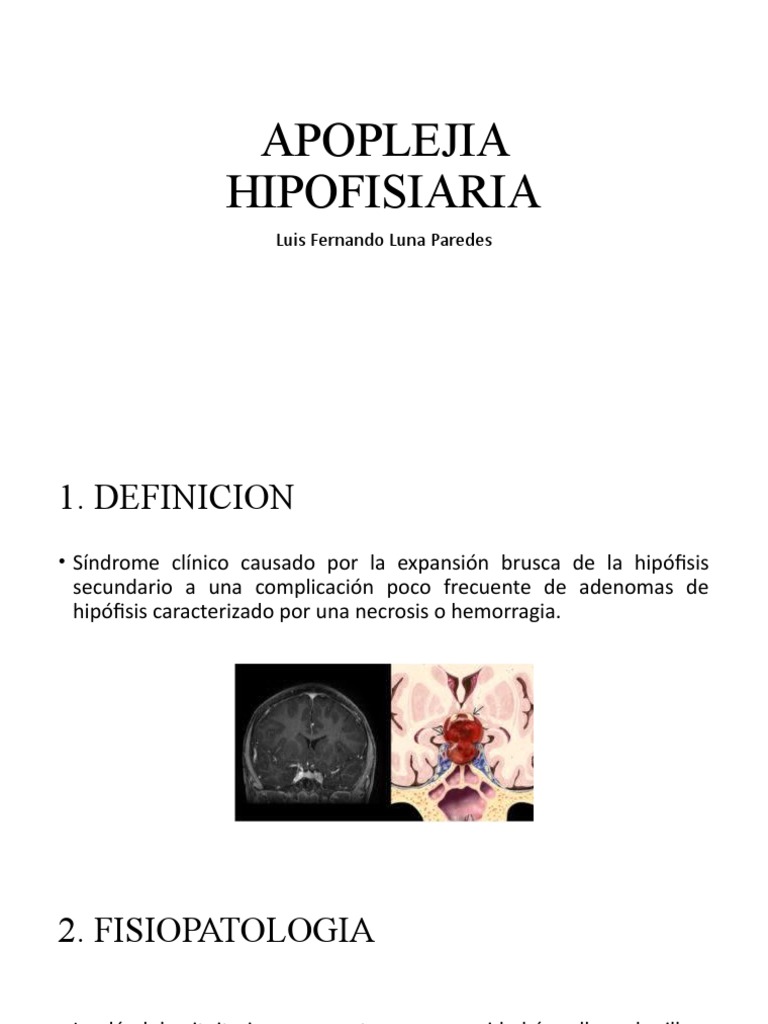 Apoplejia Hipofisiaria | PDF | Glándula pituitaria | Carrera