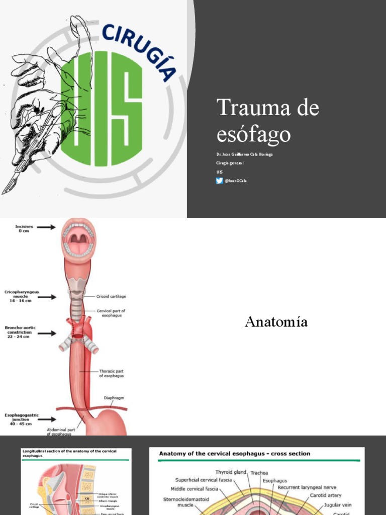 Trauma de Esófago | PDF | Gastroenterología | Órgano (anatomía)