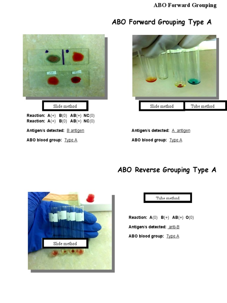 ABO Grouping BB Lab | PDF | Blood Type | Blood Donation