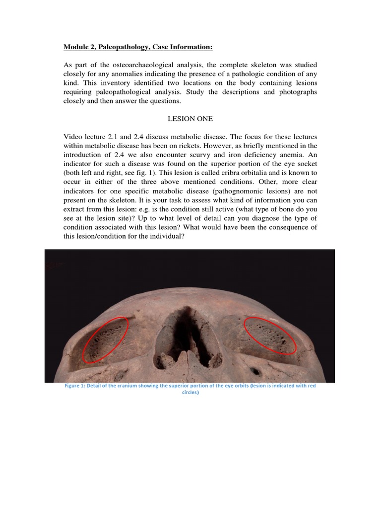 Module 2, Paleopathology, Case Information | PDF | Diseases And ...
