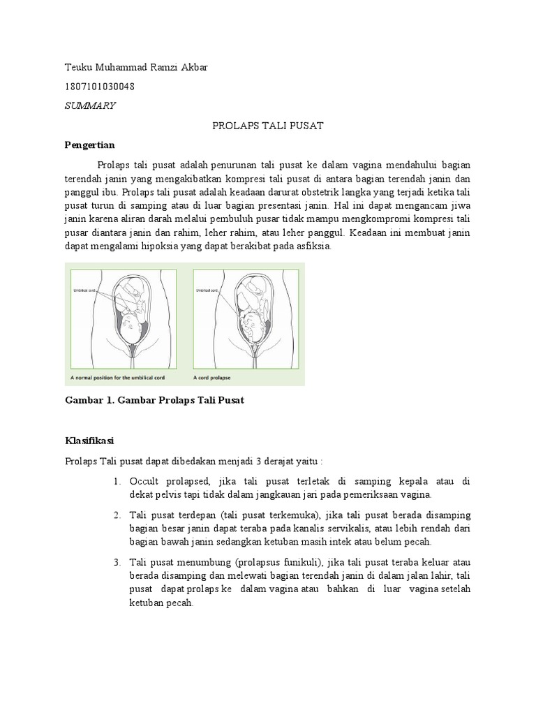Prolaps Tali Pusat | PDF