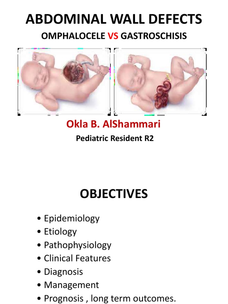 Abdominal Wall Defects: Omphalocele Gastroschisis | PDF | Congenital ...