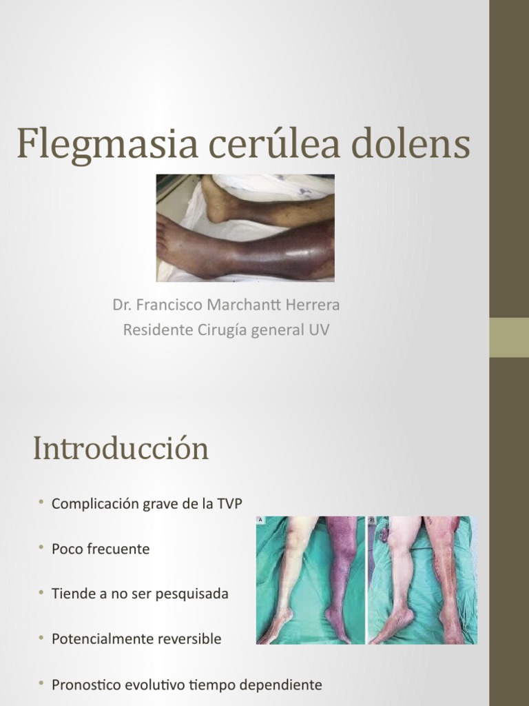 Flegmasia Cerúlea Dolens | PDF | Especialidades Medicas | Medicina CLINICA