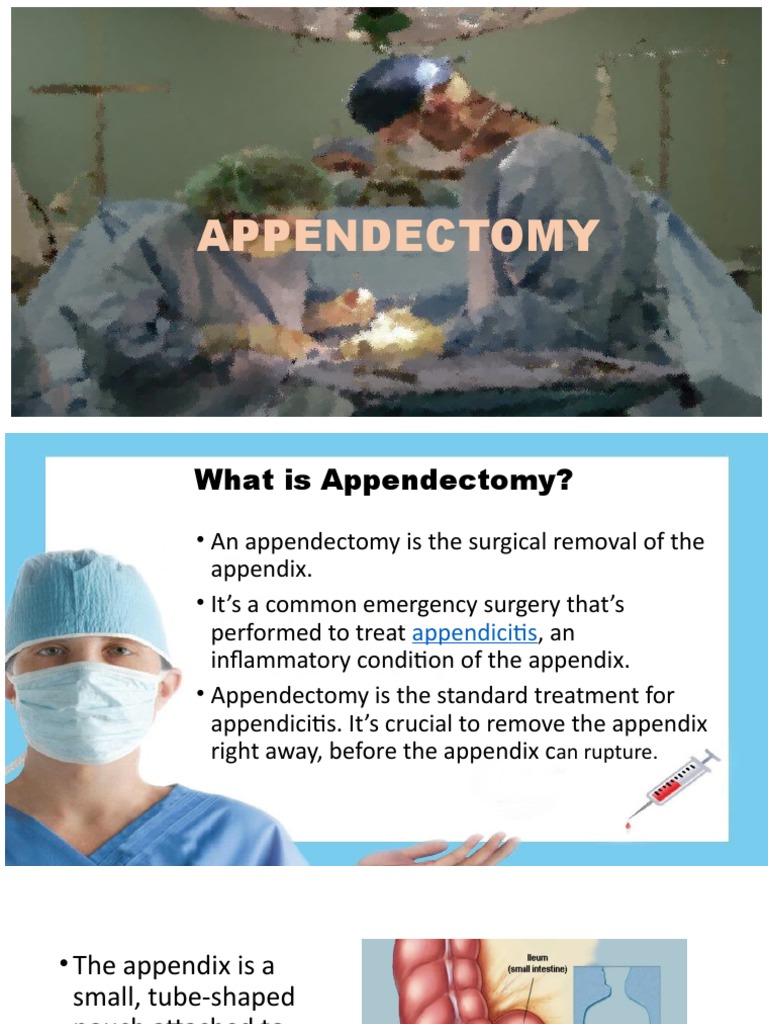 Appendectomy Overview and Procedures | PDF | Ct Scan | Medical Imaging