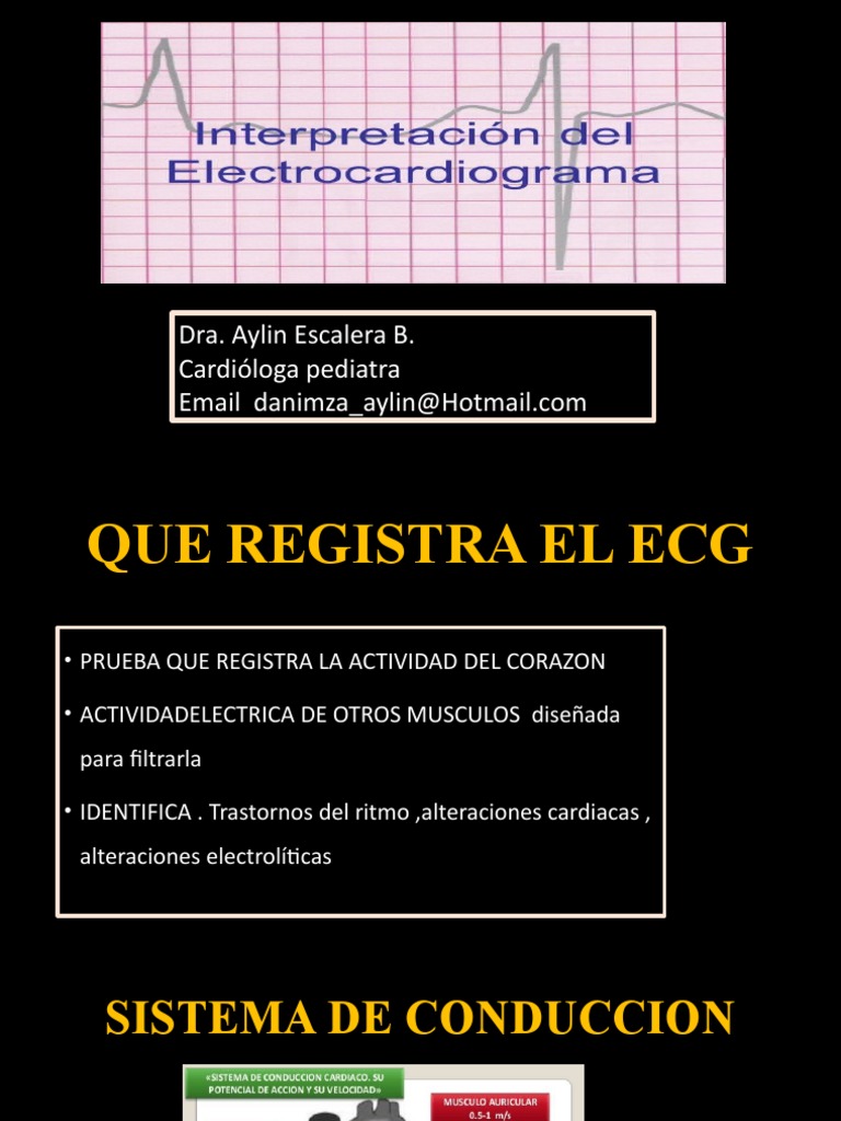 Electro Normal Hoy | PDF | Electrocardiografia | Sistema cardiovascular