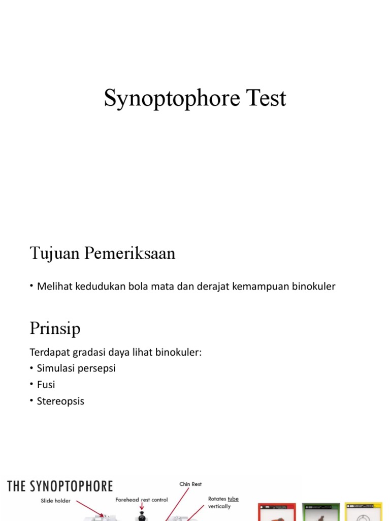 Synoptophore Test | PDF