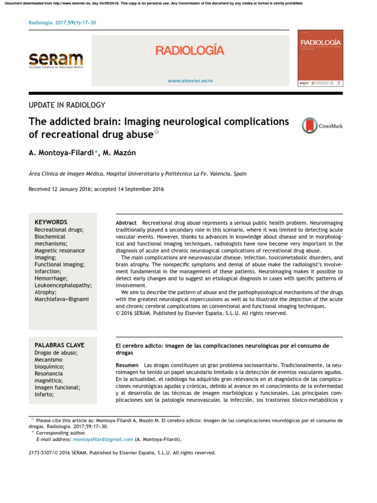 The Addicted Brain: Imaging Neurological Complications of Recreational ...