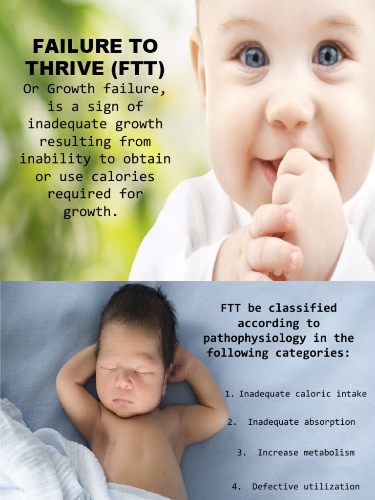 Failure To Thrive (FTT) | PDF | Child Neglect | Child Abuse