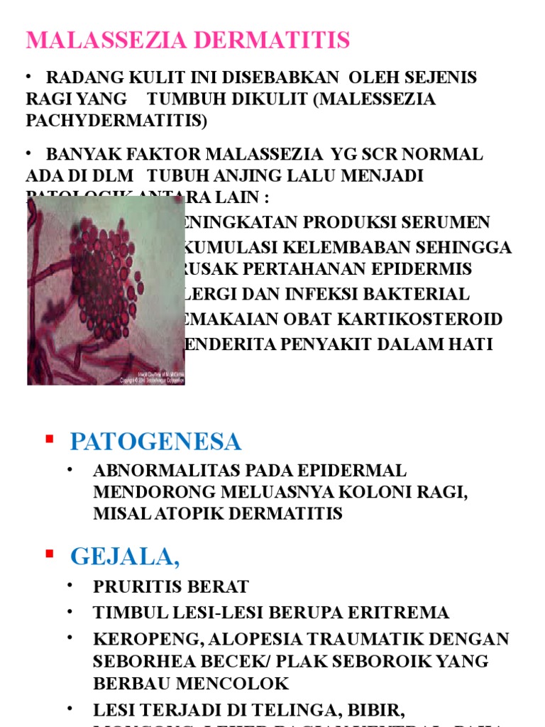 Malassezia Dermatitis: Overview and Management | PDF