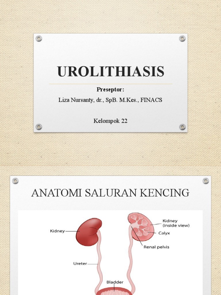 UROLITHIASIS Kel 22 | PDF