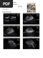 RX Abdomen Coprostasis Cambios Osteodegenerativos | PDF