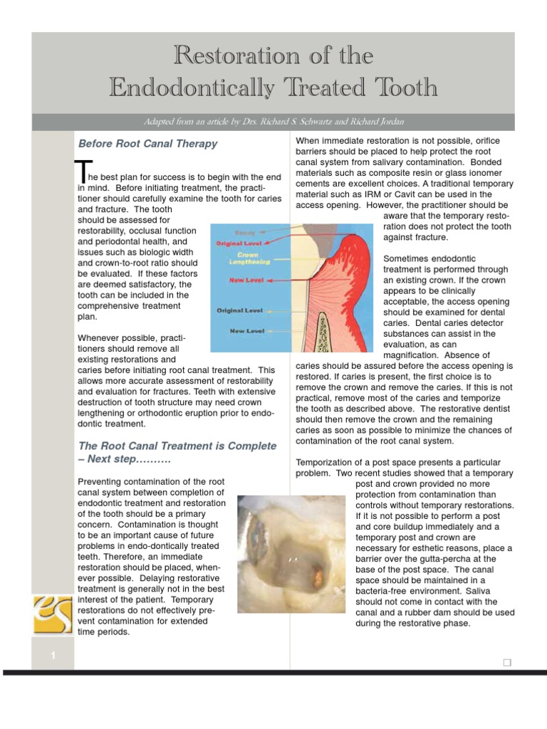Restoration of The Endo TX - 'D Tooth | PDF | Dentistry | Mouth