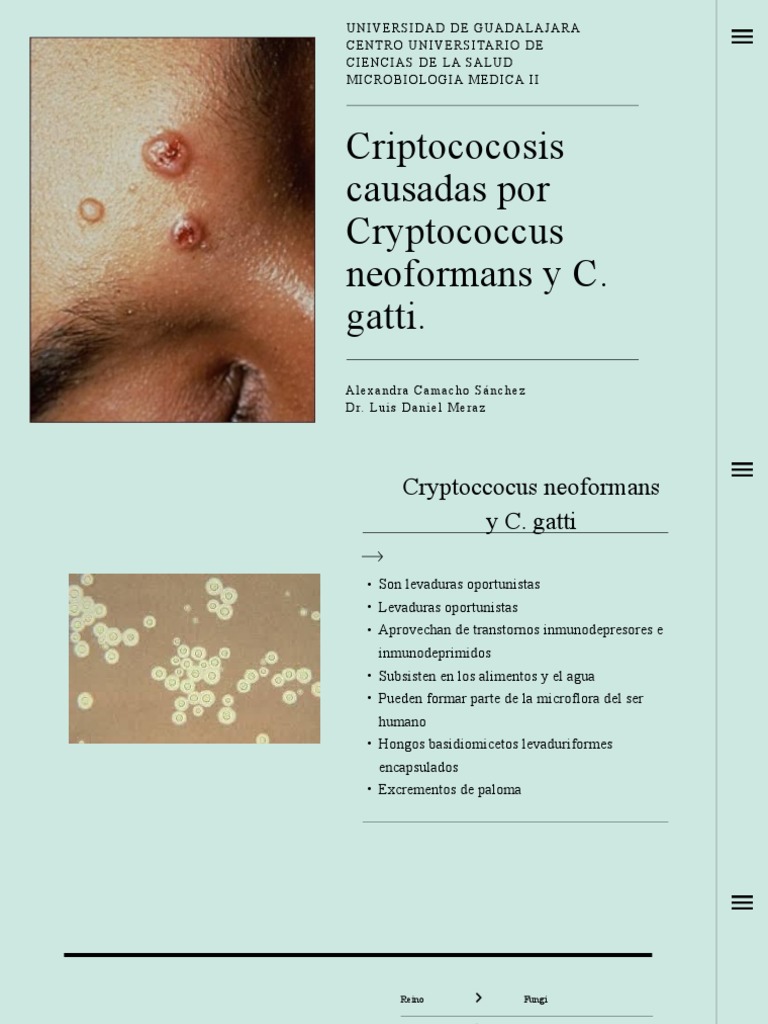 Criptococosis: Diagnóstico y Tratamiento | PDF | Neumonía ...