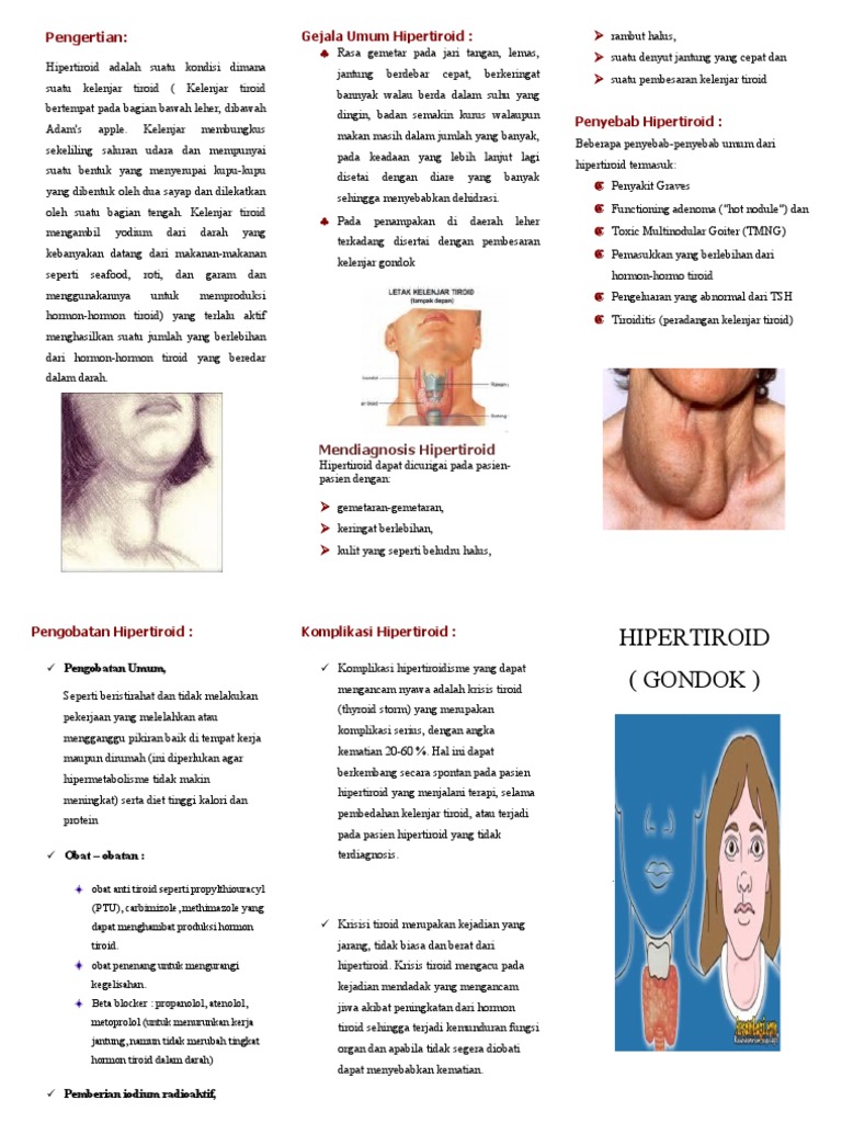 Leaflet Hipertiroid | PDF
