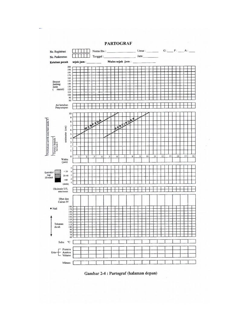Gambar Partograf (Bolak Balik) | PDF