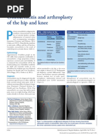 2018-1 - Classifications in Brief Tonnis Classification of Hip ...