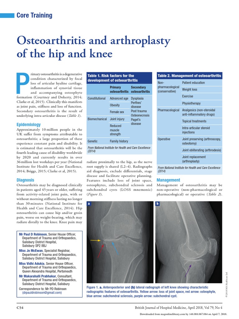 Osteoarthritis And Arthroplasty Of The Hip And Knee 2018 Pdf Pdf