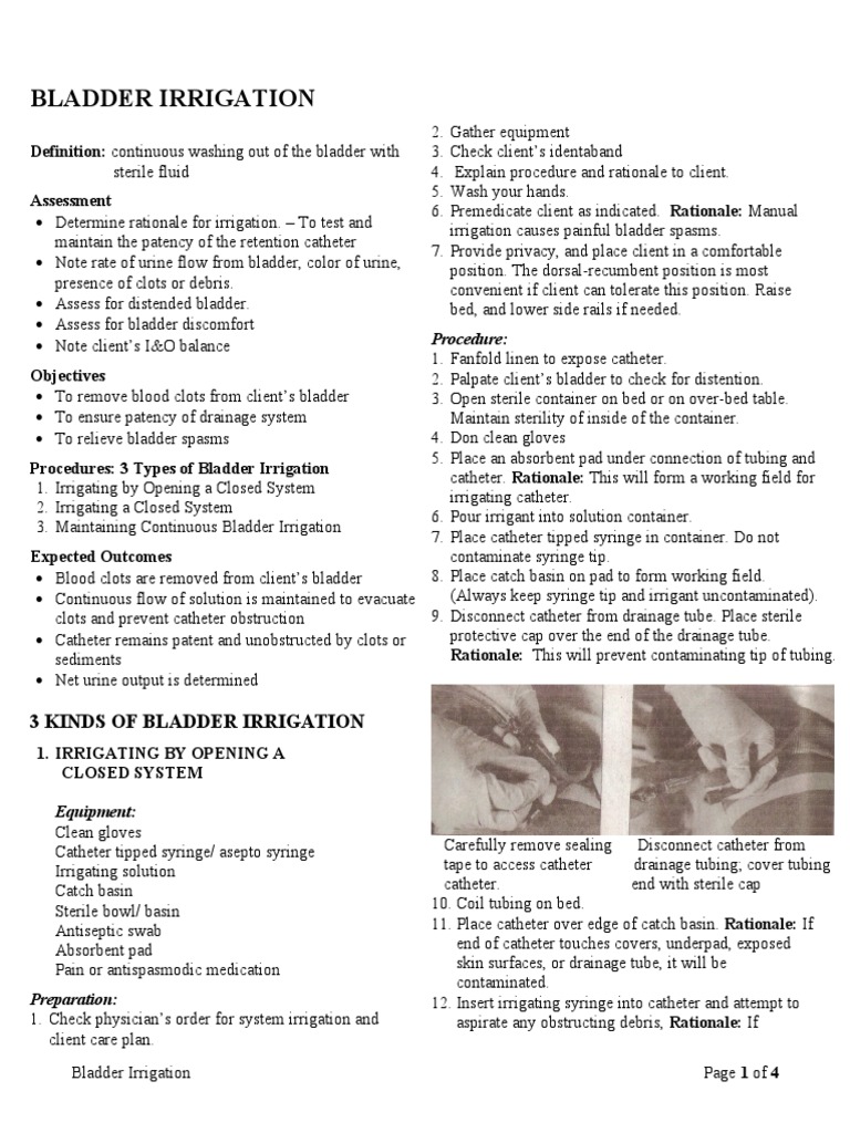 Bladder Irrigation Cystoclysis | PDF | Catheter | Syringe