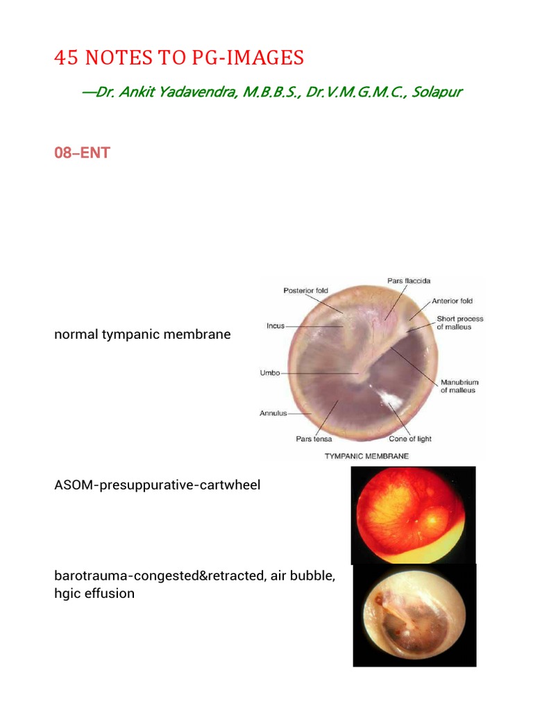 ENT Images (All in One Merged) PDF | PDF | Human Nose | Primate Anatomy
