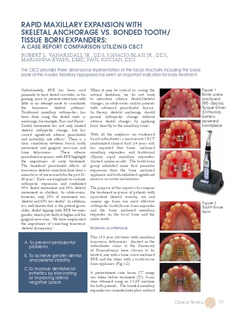 Rapid Maxillary Expansion With Skeletal | PDF | Periodontology | Skull