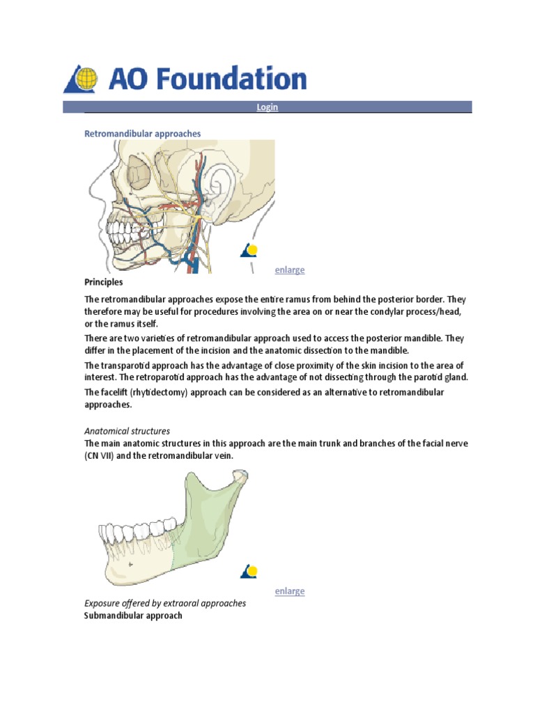 Retromandibular Approaches | PDF | Surgery | Wound