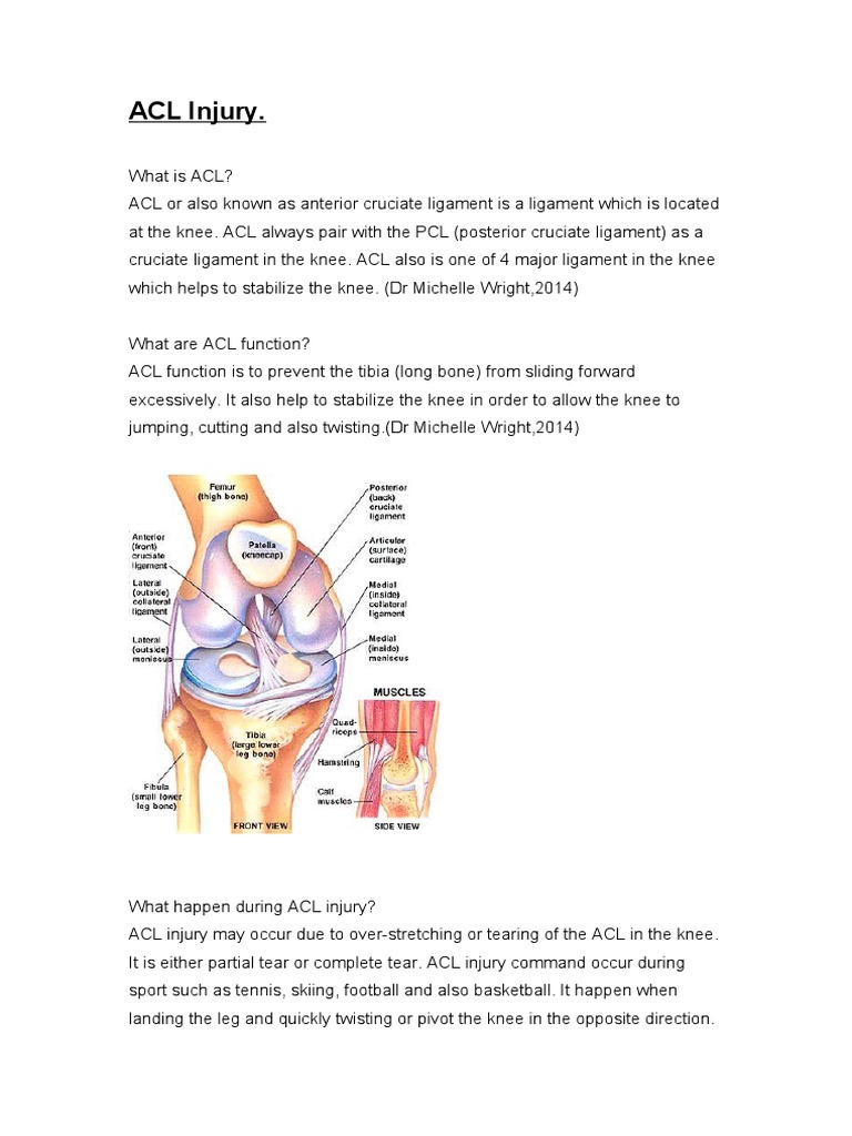 ACL Injury | PDF