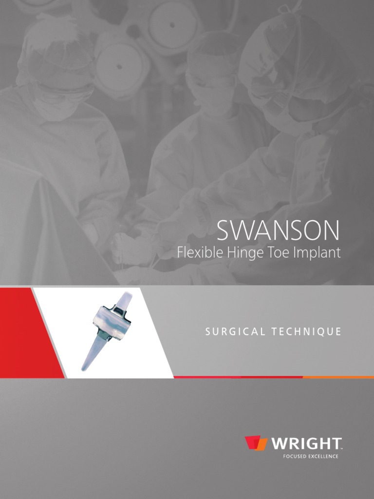 Swanson: Flexible Hinge Toe Implant | PDF | Toe | Anatomical Terms Of ...
