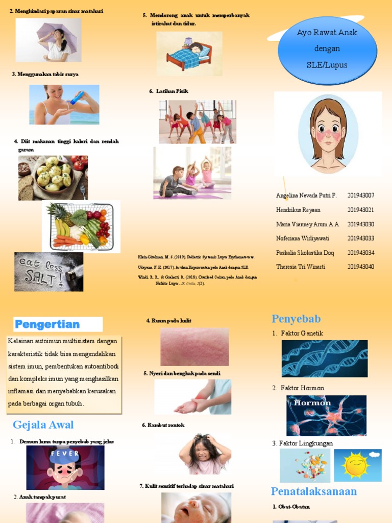 Penanganan SLE pada Anak | PDF