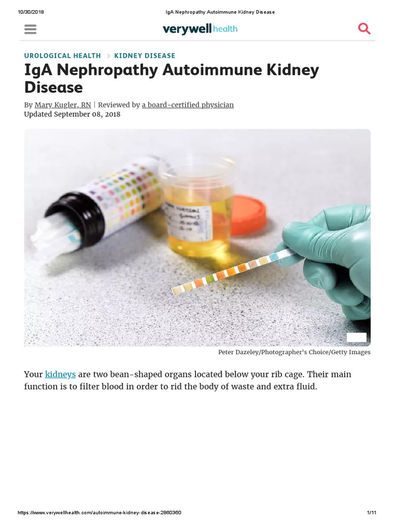 IgA Nephropathy: An Overview of this Autoimmune Kidney Disease ...