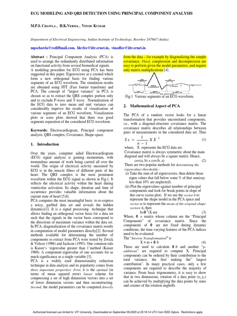 QRS Detection Using PCA | PDF | Principal Component Analysis | Eigenvalues And Eigenvectors
