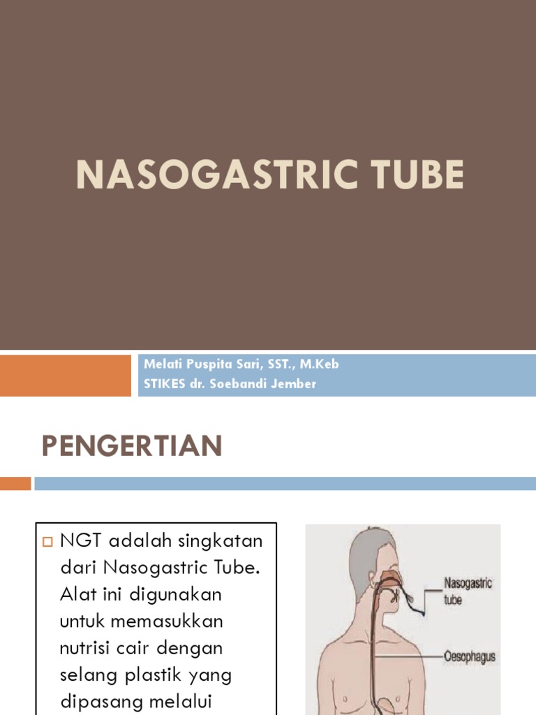 Nasogastric Tube (NGT) PDF | PDF