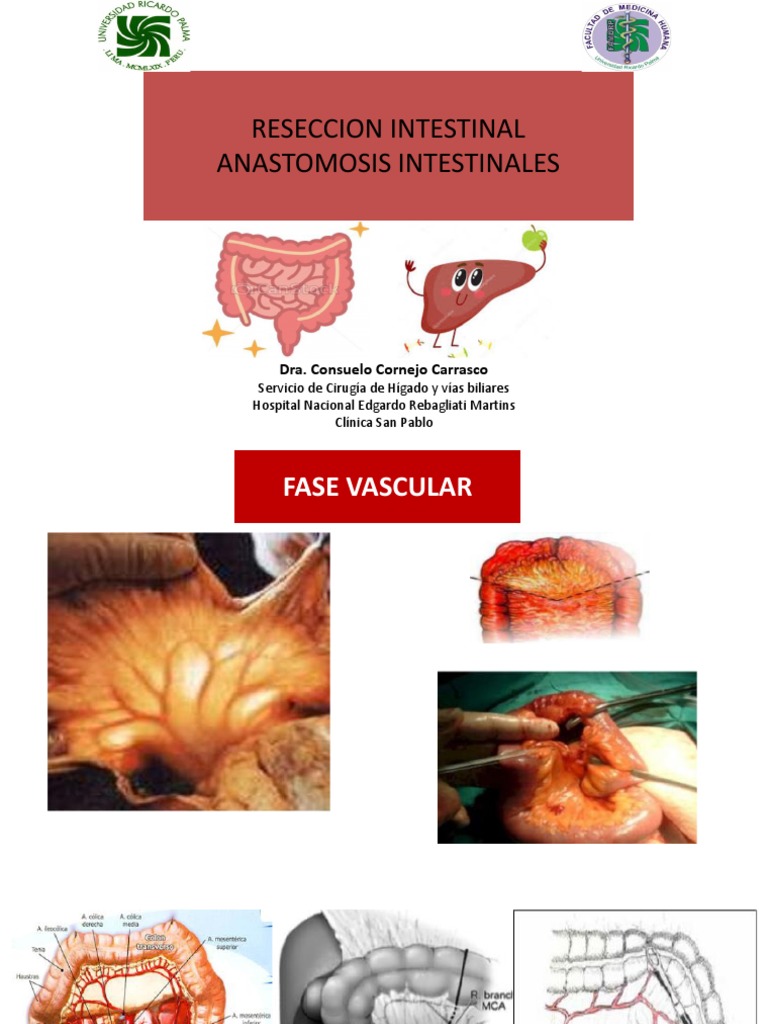 Reseccion Intestinal PDF | PDF | Enfermedades y trastornos | Medicina