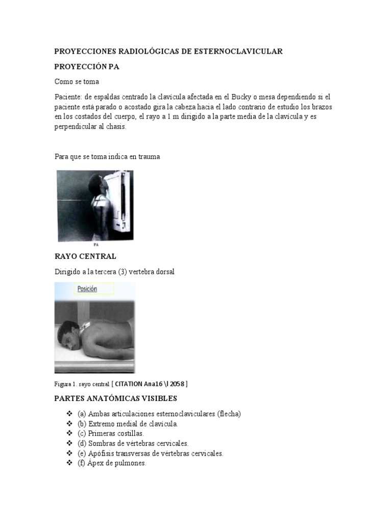 Proyecciones Radiológicas Esternoclaviculares | PDF