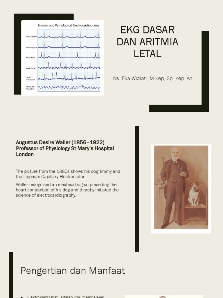 Ekg Dasar Dan Aritmia Letal | PDF
