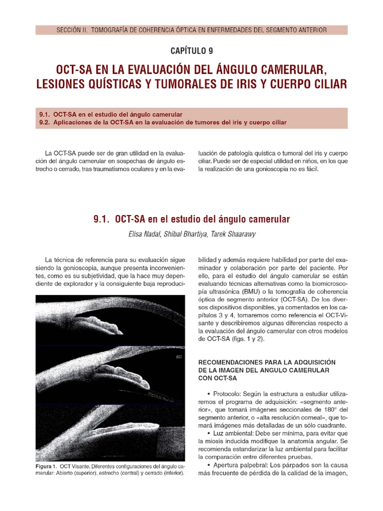 Oct-Sa en La Evaluación Del Ángulo Camerular | PDF