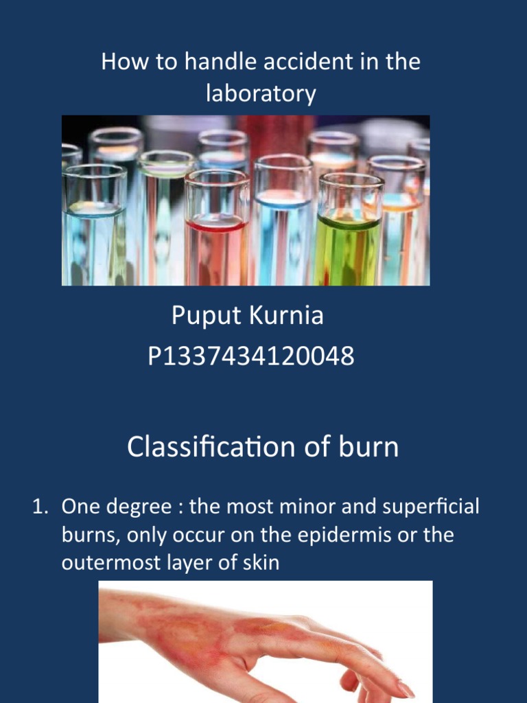 Laboratory Burn Treatment Guide | PDF