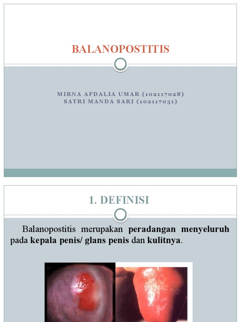 Balanopostitis | PDF