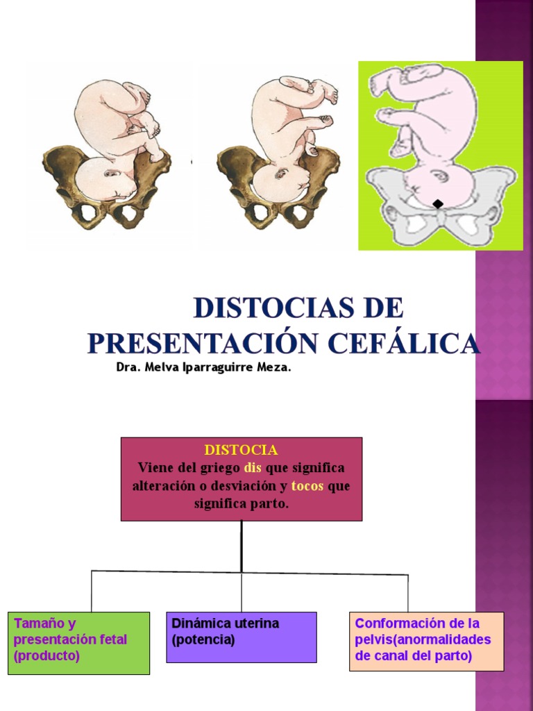 Distocias de Presentación Fetal | PDF | Parto | Pelvis