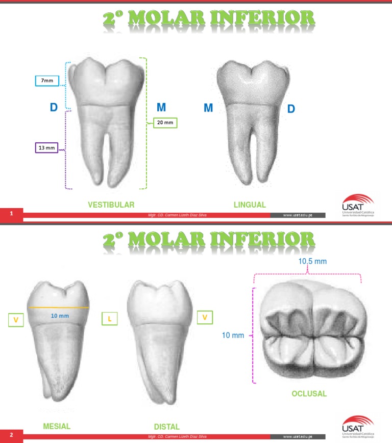 Diagrama 2 Molar Inferior | PDF